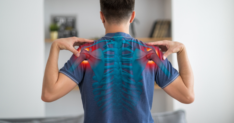Cervical Radiculopathy vs Shoulder Pain: How to Tell the Difference